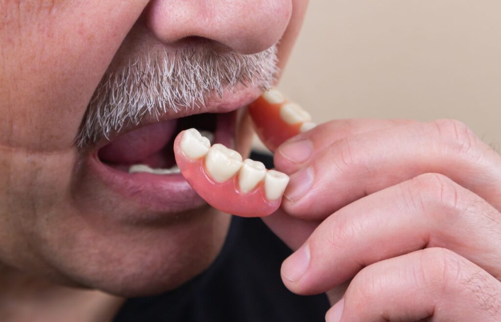 Denture Options for Every Need in Essex