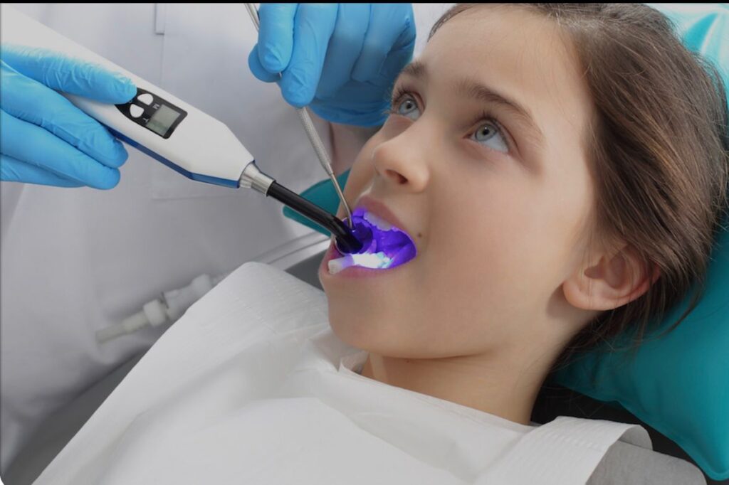 Fissure Sealant: Protect Your Teeth from Cavities