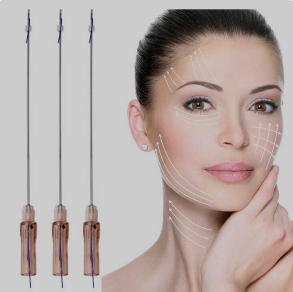 Thread Lift: Your Guide to Youthful Skin in Essex